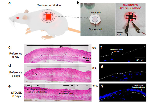 Sandwich-structure transferable free-form OLEDs for wearable and ...