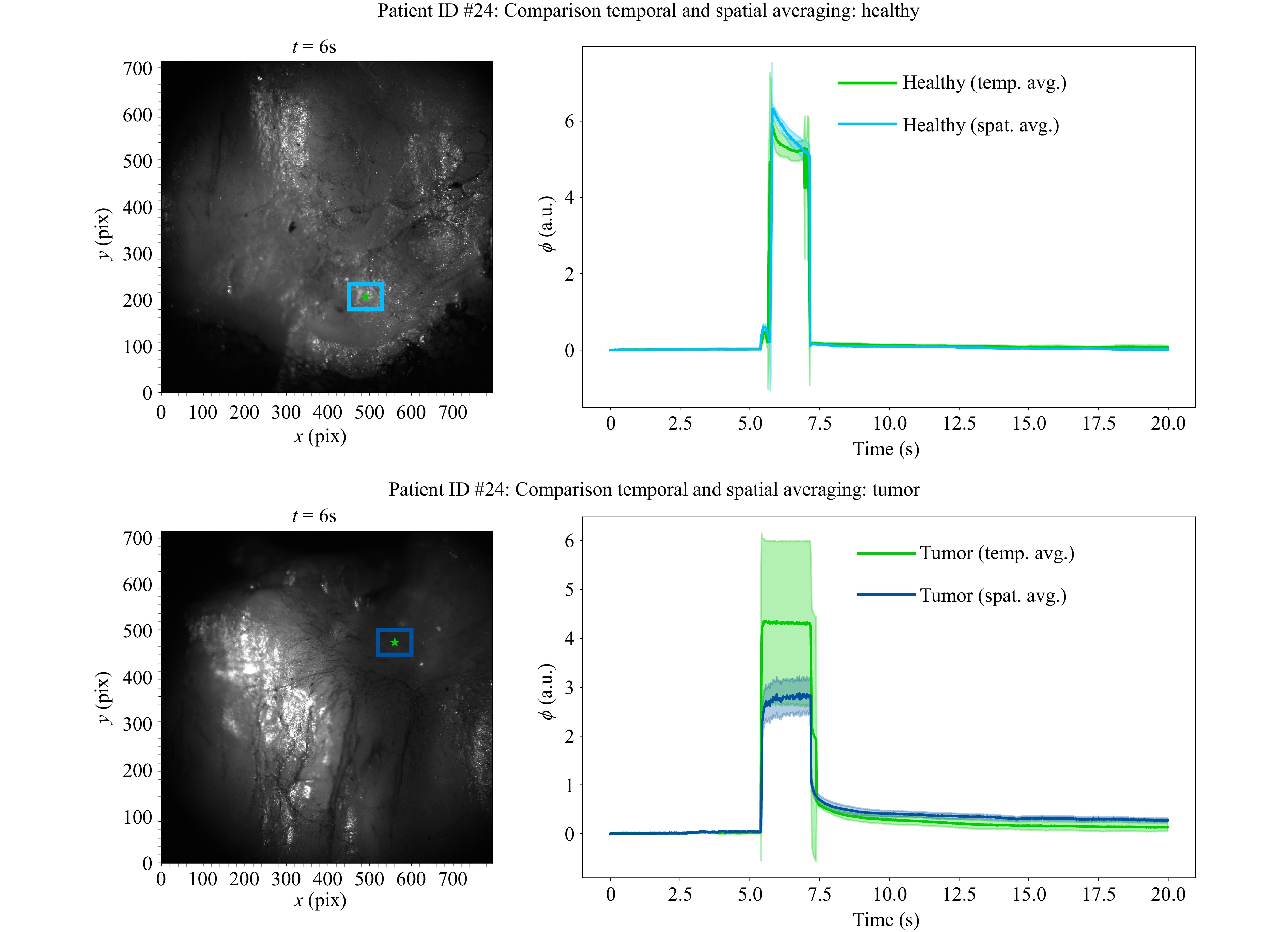 Bimodal tissue differentiation using hyperspectral imaging and ...